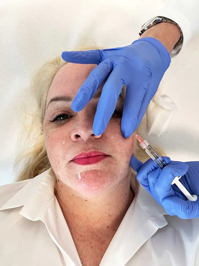 Wir testen die PROFHILO Bio-Remodellierung in der Dermis Hautklinik ...